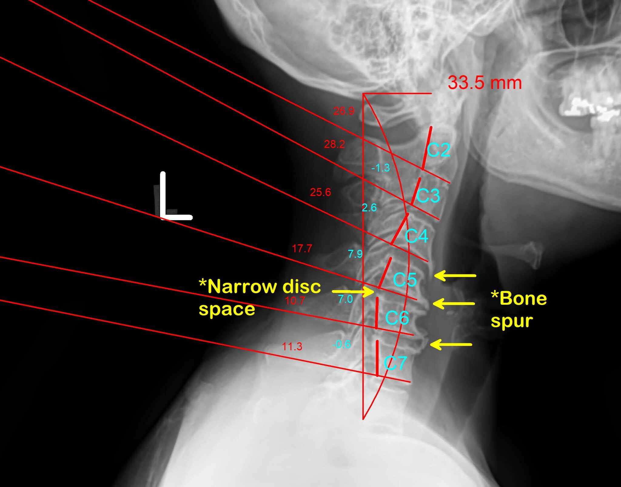 Digital X-Ray Services In Kuala Lumpur | Osso Bone Care