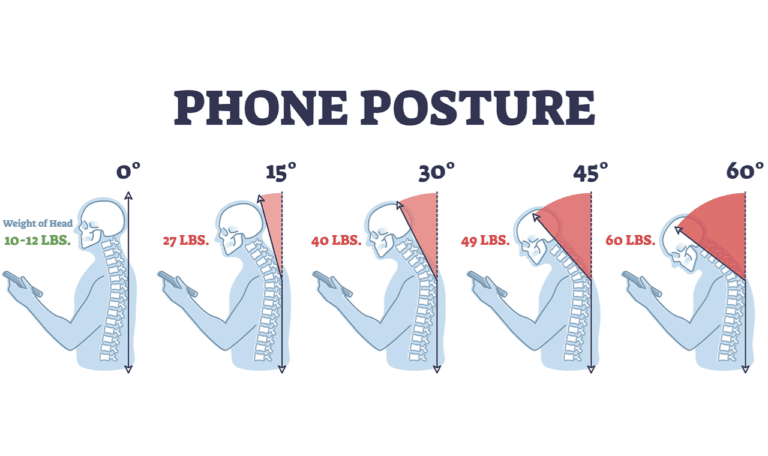 The Impact Of Forward Head Posture And How To Correct It
